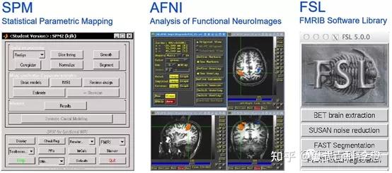 磁共振脑功能成像——任务态fMRI简介 - 知乎