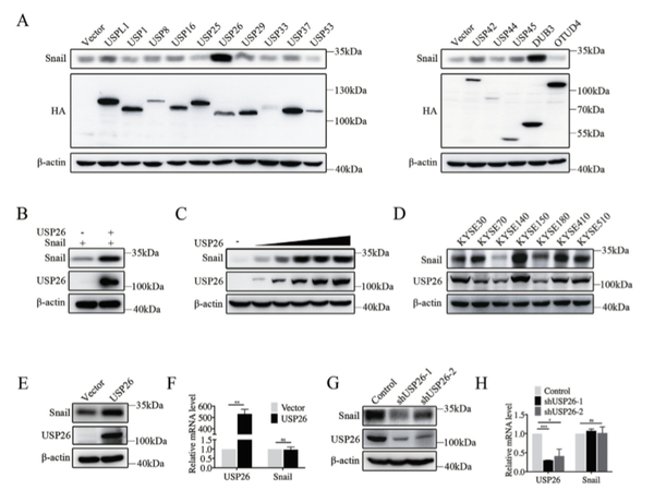 USP26通过稳定Snail促进食管鳞状细胞癌转移 - 知乎