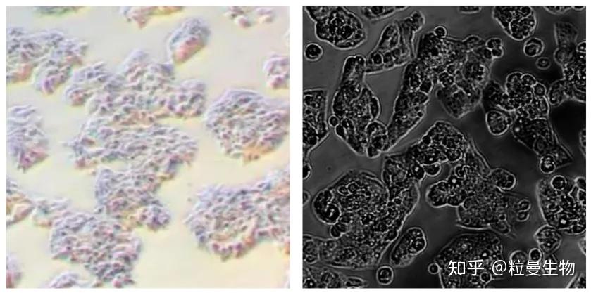 一叶知秋 | Hep G2（人肝癌细胞）的培养与编辑 - 知乎