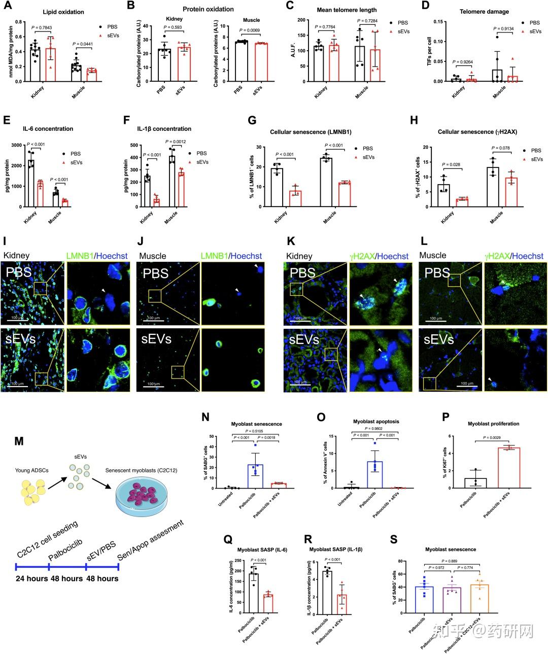 Science丨年轻个体内的sEV可延缓年老个体的衰老 - 知乎