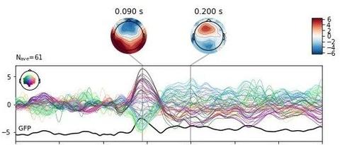 MNE-Python处理脑电教程汇总 - 知乎