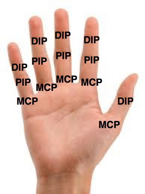 康复第一课：手把手教你手指关节ROM测量 - 知乎