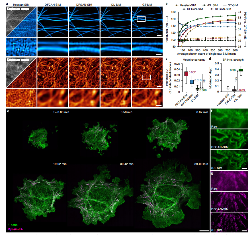 Nat. Biotechnol. | 用于快速亚细胞过程持续实时成像的合理化深度学习超分辨率显微镜 - 知乎