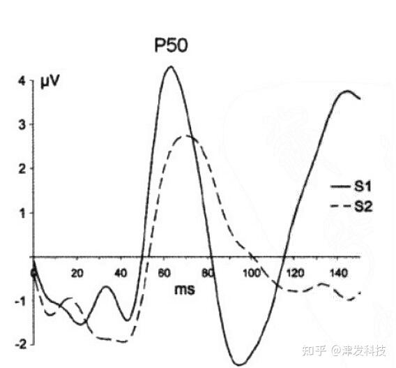 脑电常见的ERP成分 - 知乎