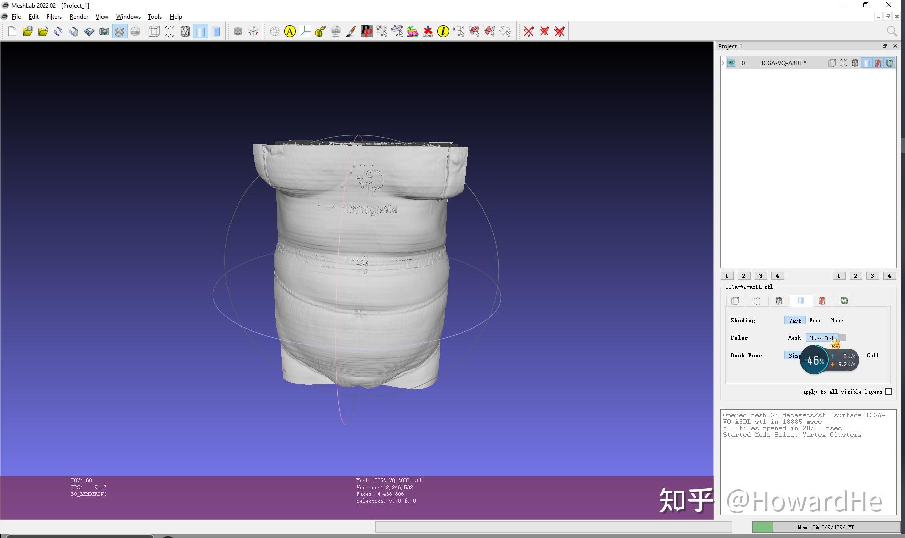 从消化道CT扫描图像到消化道三维模型的工作流（TCIA+InVesalius+MeshLab） - 知乎