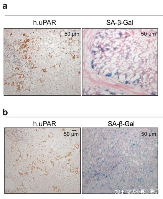 Nature丨“返老还童”新突破：uPAR助力CAR-T提高抗衰老效果 - 知乎