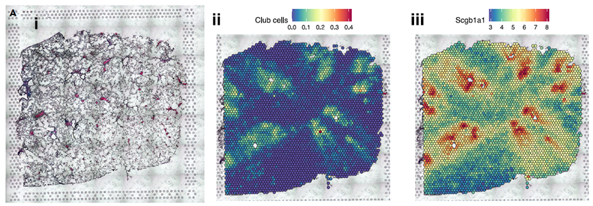 生信分析 | 空间转录组·SPOT去卷积—RCTD - 知乎