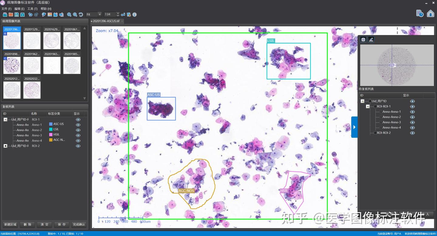 助力医学临床AI — MISAT医学图像分割与标注软件套装 - 知乎