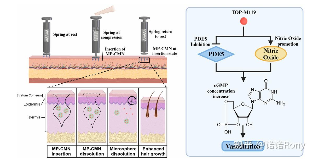 【专题笔记】微球载药微针的制备与应用2 - 知乎