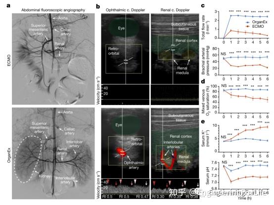 《Nature》重磅：继猪脑“复活”后的又一重大突破，OrganEx助力“起死回生” - 知乎
