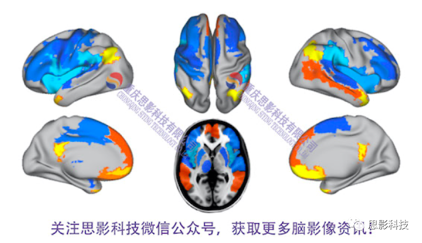 思影科技功能磁共振(fMRI)数据处理业务 - 知乎