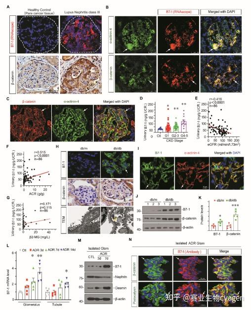 南方医院发现足细胞损伤的重要机制，有望改善靶向B7-1的肾病疗法 - 知乎