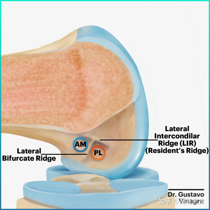 前交叉韧带重建的点位与康复 - 知乎