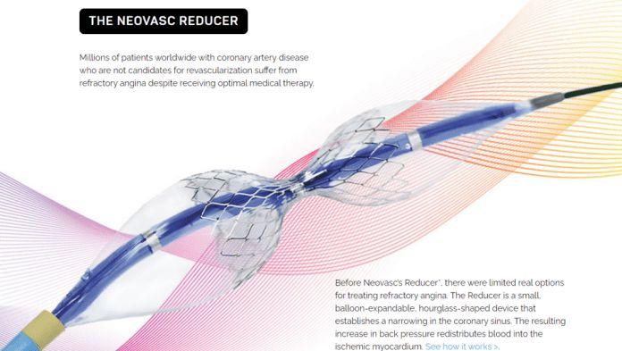 730亿！波士顿科学有意收购Shockwave Medical - 知乎
