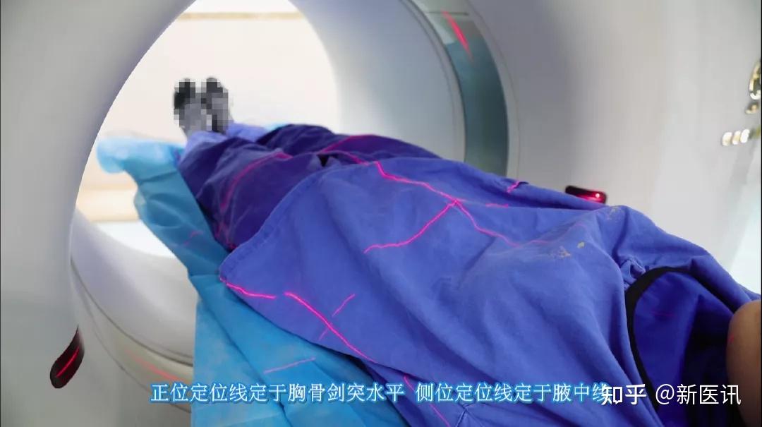 检查规范第八期 | 双下肢CTV检查规范化流程、用语及检查要点 - 知乎