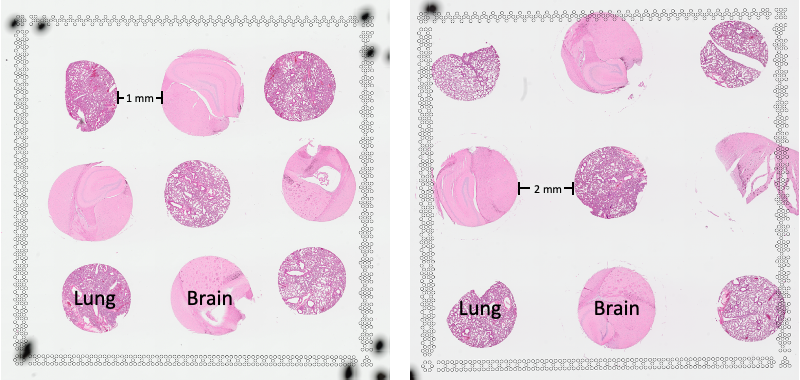 组织芯片（TMA）能与10x Genomics Visium CytAssist FFPE空间基因表达分析兼容吗？ - 知乎