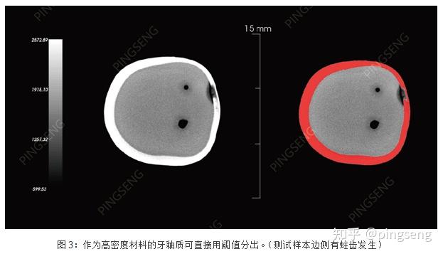 Micro CT在齿科研究中的应用 - 知乎
