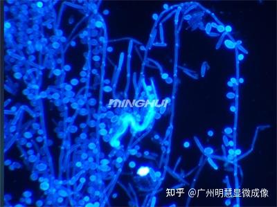荧光显微镜UB203i-FL应用于真菌检测 - 知乎
