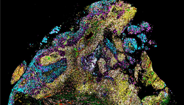 从临床试验到IVD应用，解锁mIHC真正价值（含mIHC抗体验证列表）| 讲座 - 知乎