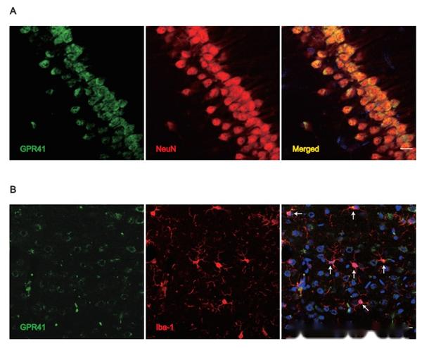 Microbiome | 微生物-肠道-脑轴通过干扰短链脂肪酸的代谢参与慢性脑灌注不足慢性脑灌注不足 - 知乎