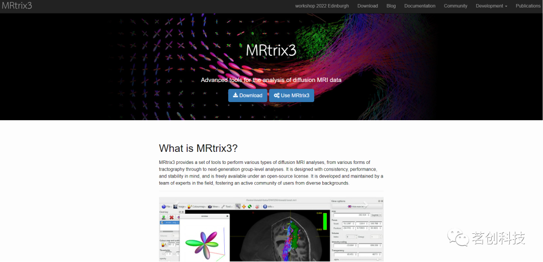 磁共振弥散成像(dMRI)分析方法 - 知乎