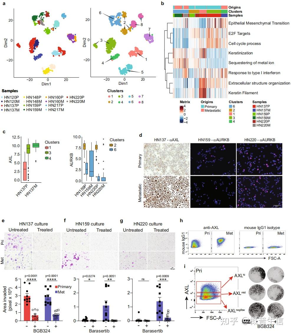 NC | 17的肿瘤转移做了什么？ - 知乎