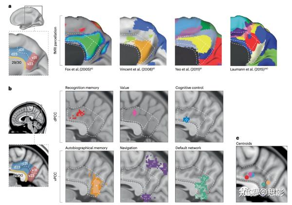 后扣带回的三分视角 - 知乎