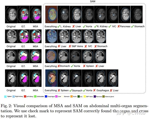 视觉大模型系列 | MSA：一种简单强大的医学 SAM 适配器，轻松强化 SAM 到指定领域 - 知乎