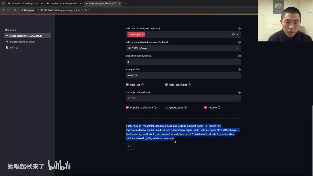 DeepPrep-基于深度学习的fMRI预处理工具 - 知乎