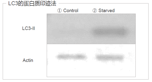 干货丨细胞自噬研究 - 知乎