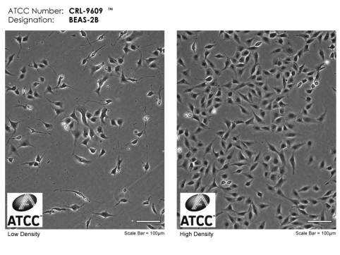 BEAS-2B细胞培养，人支气管上皮细胞培养攻略 - 知乎