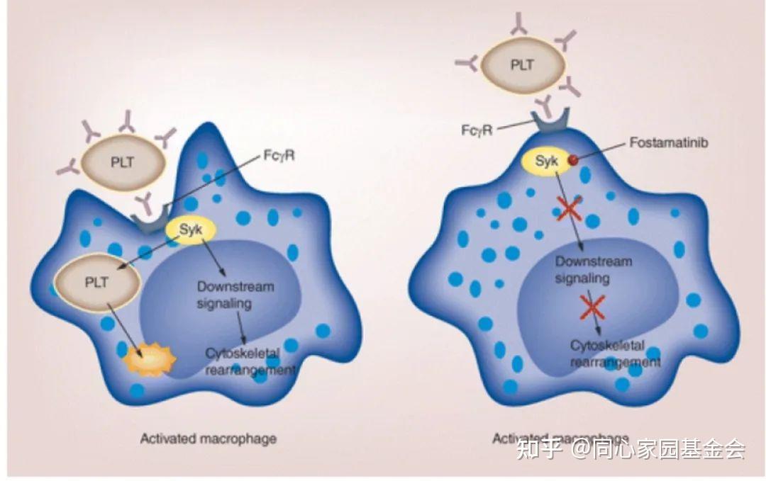专家讲座 | ITP患者必读，周泽平教授带您解读治疗全方案 - 知乎