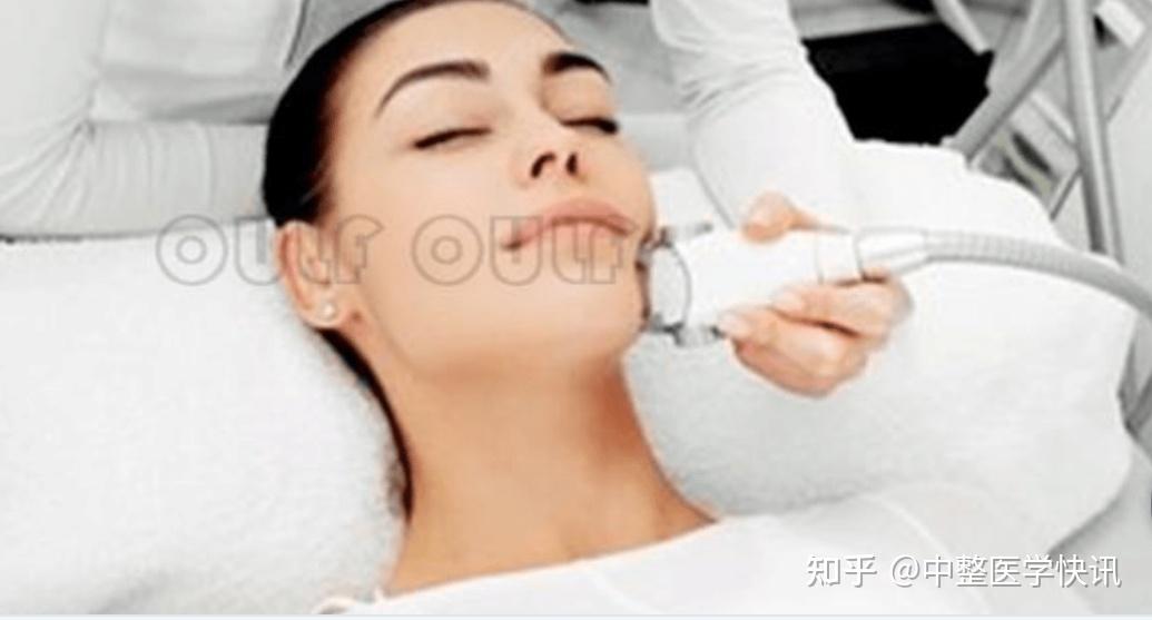 嘘~超声炮一般全脸打多少发、半岛超声炮多少发才有效?打的发数越多越好吗? 知乎