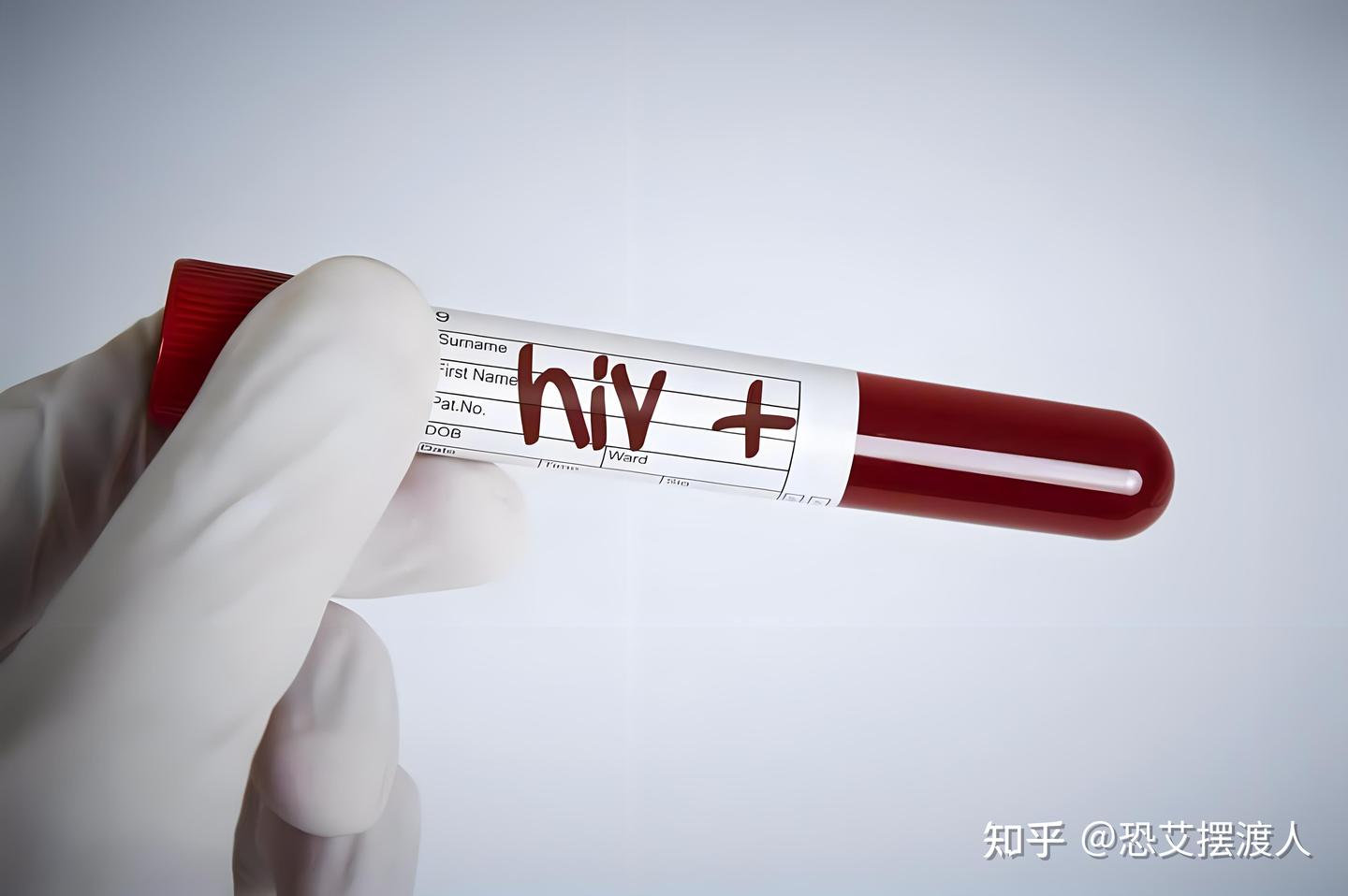 HIV-2型知多少 - 知乎