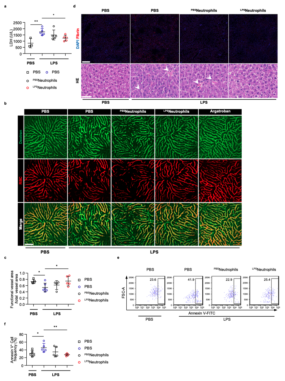 Nature Communications丨中性粒细胞通过释放SOD2囊泡保护脓毒症小鼠 - 知乎