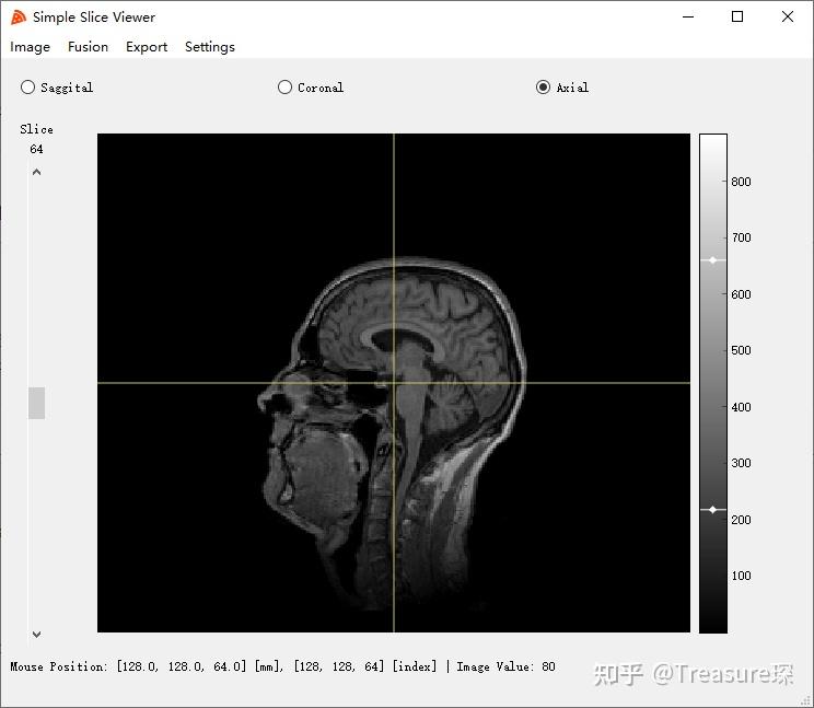 Python科研图像处理——Slice Viewer - 知乎