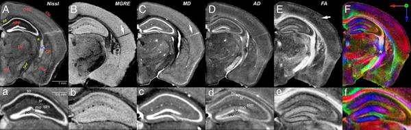 再次刷新！PNAS发布迄今为止最高分辨率的小鼠大脑MR图像 - 知乎
