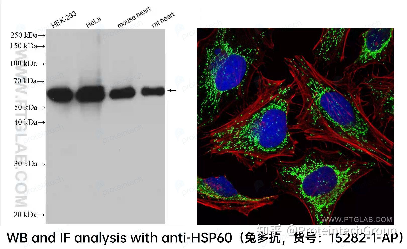 WB指南 | 18种常用WB内参大盘点！码住！ - 知乎