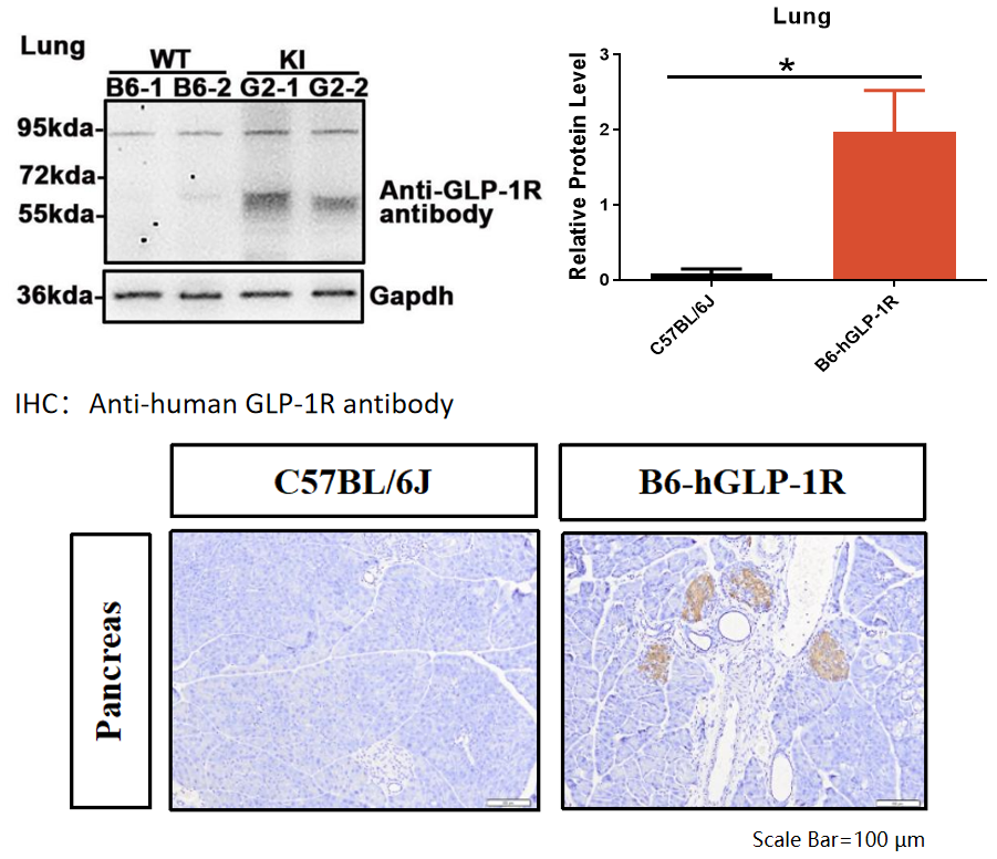 糖尿病模式动物研究明星靶点：胰高血糖素样肽1受体 (GLP-1R) - 知乎