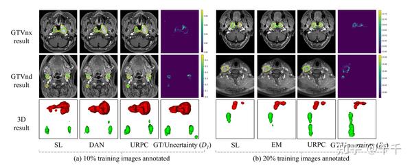 Semi-supervise d me dical image segmentation via uncertainty rectified ...