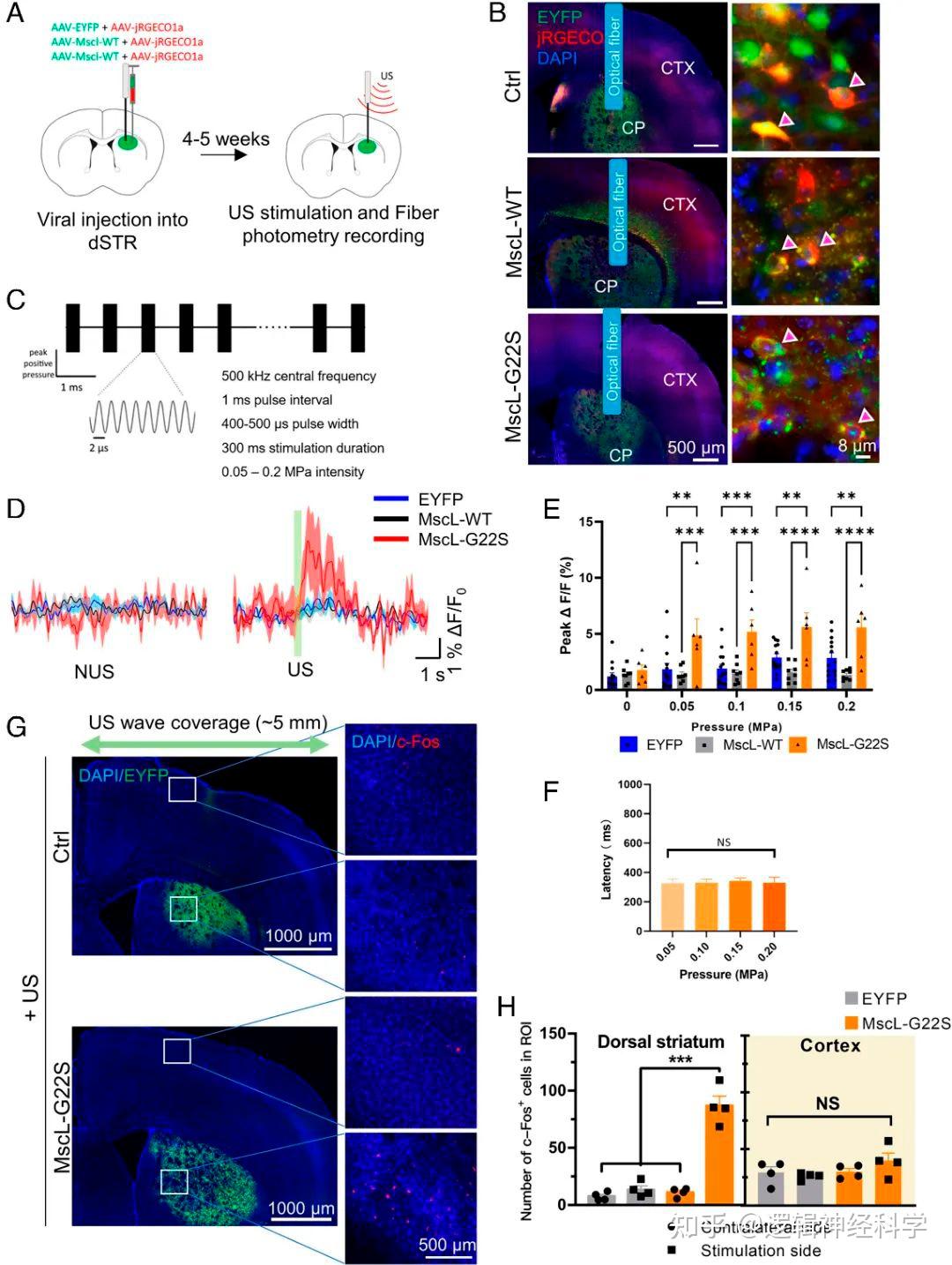 PNAS︱香港理工大学孙雷课题组利用无创神经元类型靶向的超声遗传学方法调控深部脑区，并有效改善帕金森疾病小鼠模型的运动障碍 - 知乎