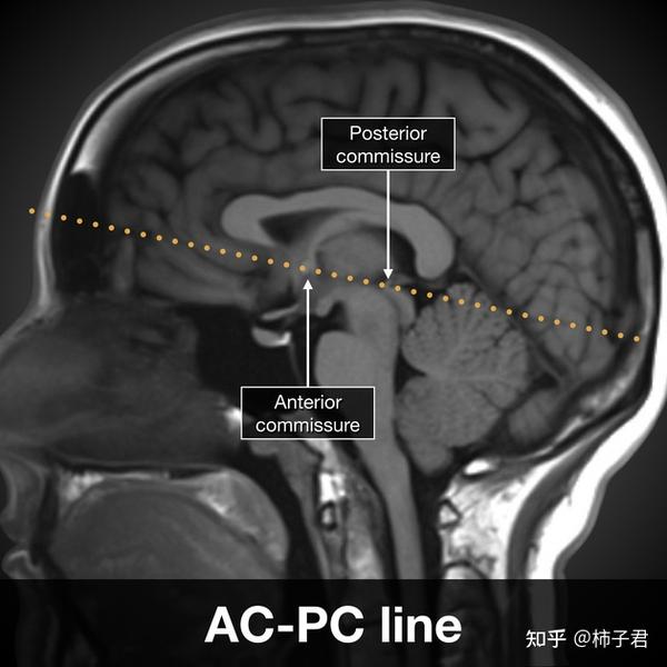 EEG|预备知识1 - 知乎