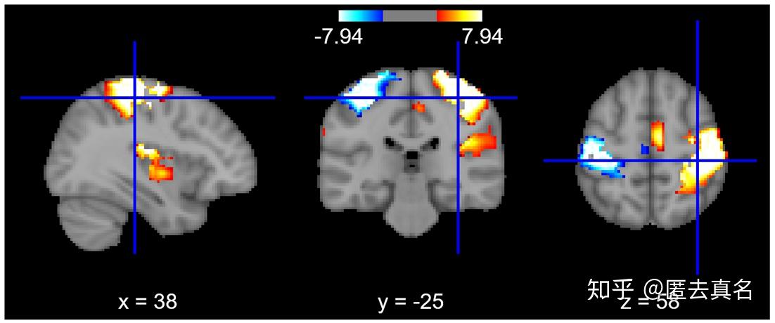 nilearn 笔记（5） - 知乎