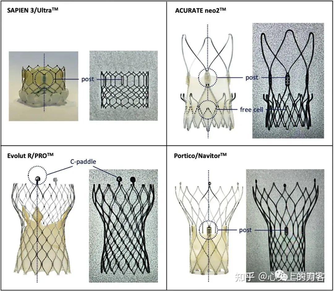 连合对齐（Commissural Alignment）：原理、定义、技术和结果（上） - 知乎