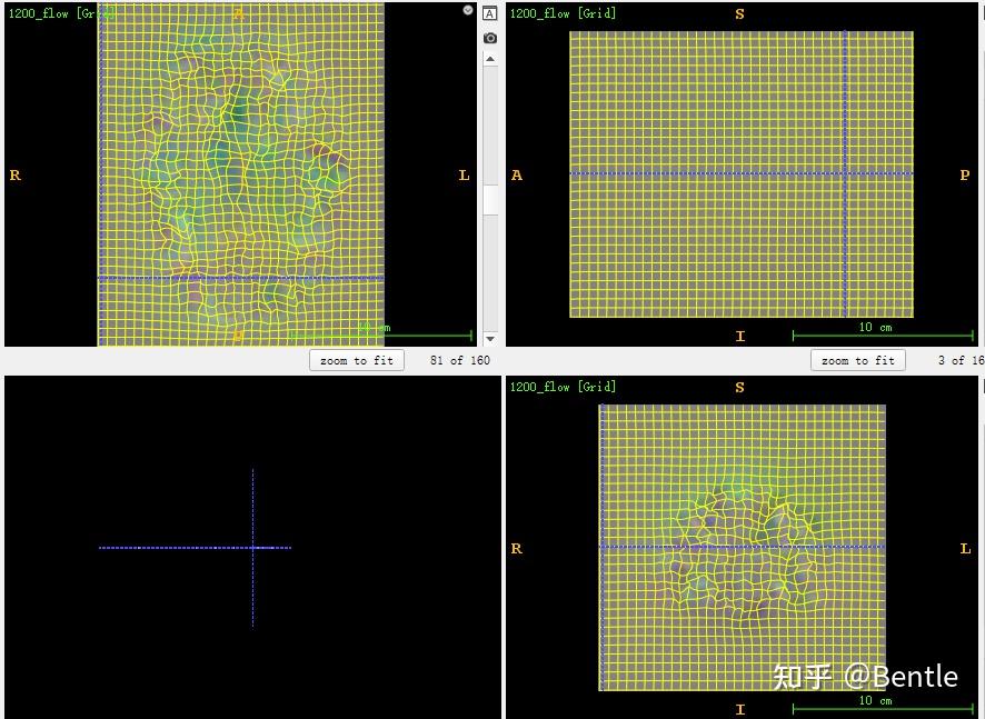 基于Voxelmorph的医疗图像配准 - 知乎