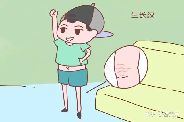 祛除生长纹可以试试这几种方法 知乎