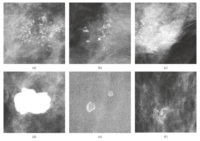 CMMD (中国乳腺X线摄影数据库) 数据集介绍 - 知乎