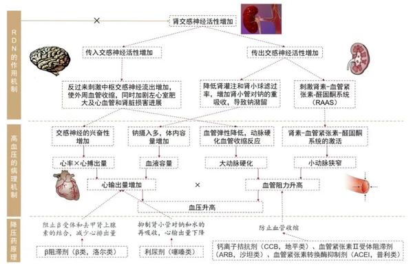 一文了解经肾动脉去交感神经术（RDN） - 知乎
