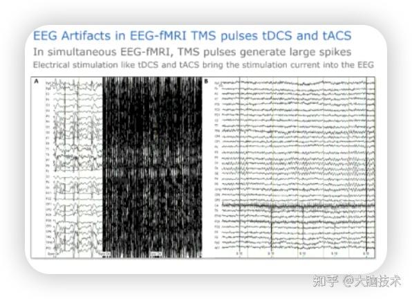 常见EEG伪迹波形图（基于analyzer分析软件展示） - 知乎