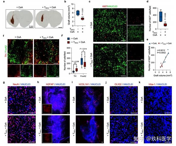 帕金森病细胞疗法曙光！下一步将深入研究如何提高多巴胺能神经元的存活 - 知乎